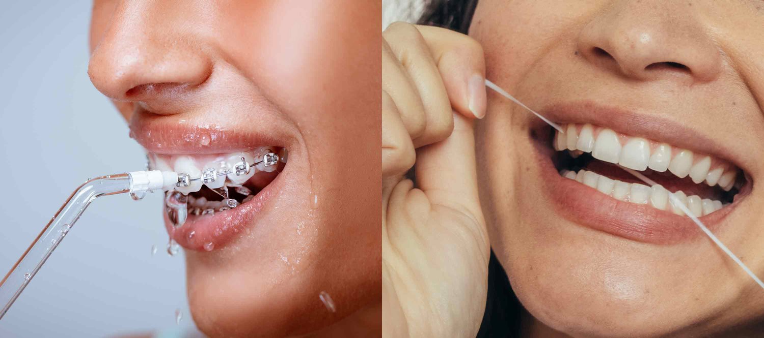 Water Flossers vs. Traditional Floss: The best dental routine?